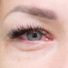 Eye Lash Extension Reactions: An Ultimate Guide From Symptoms To Remedies