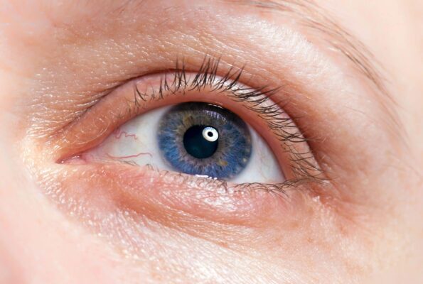 6 Proven Ways To Achieve Longer And Thicker Eyelashes